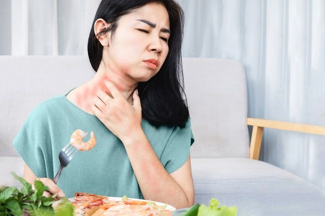 Gatal Alergi Makanan, Redakan dengan Berbagai Cara Berikut Ini - Alodokter