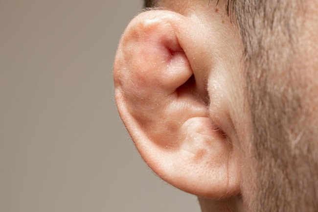 Cauliflower Ear, Kondisi Telinga Menyerupai Kembang Kol - Alodokter