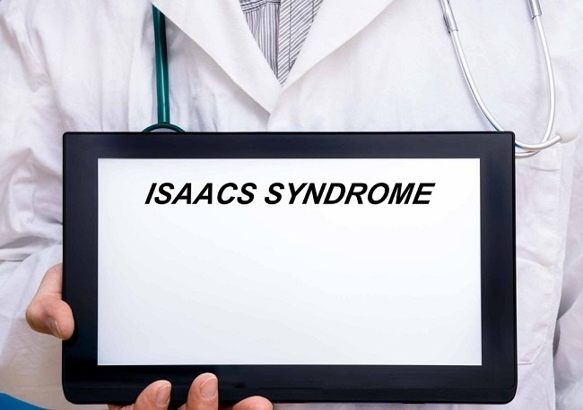 Isaac Syndrome, Gangguan yang Menyebabkan Otot Bergerak Tidak ...