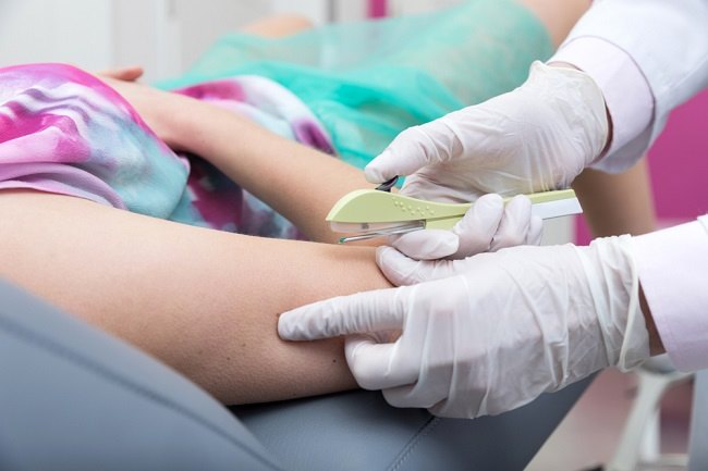 5 Efek Samping KB Implan dan Cara Mengatasinya - Alodokter