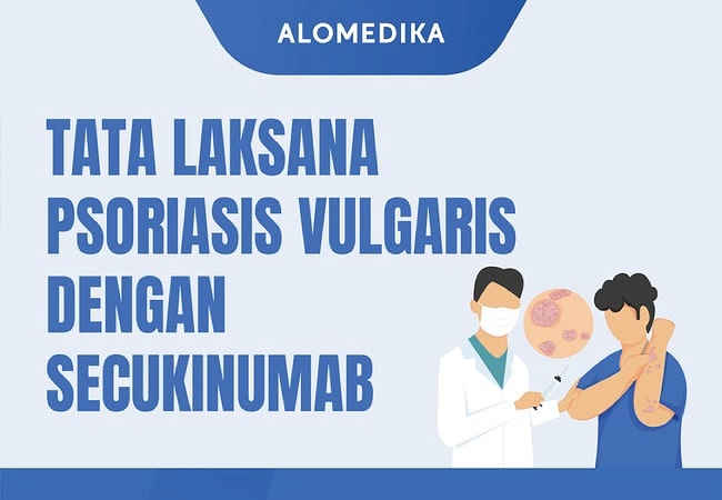 Tata Laksana Psoriasis Vulgaris dengan Secukinumab - Alomedika
