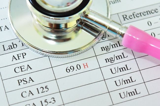 Potensi Risiko Skrining Prostate Specific Antigen (PSA) - Alomedika