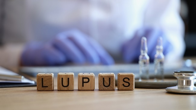 9 Gejala Lupus pada Wanita yang Perlu Diketahui - Alodokter