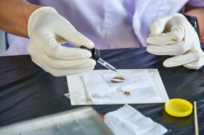 Pemeriksaan Feses, Ini yang Perlu Diketahui - Alodokter