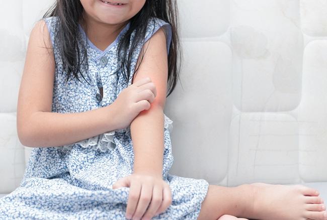 6 Obat Gatal Anak yang Aman dan Efektif - Alodokter