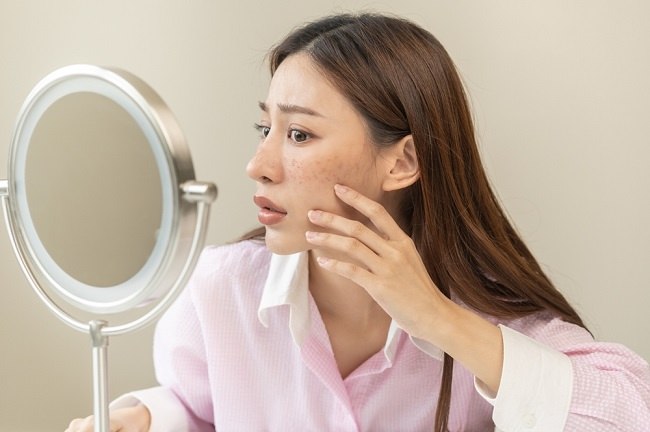 Flek Hitam di Wajah, Kenali Penyebab hingga Cara Mengatasinya - Alodokter
