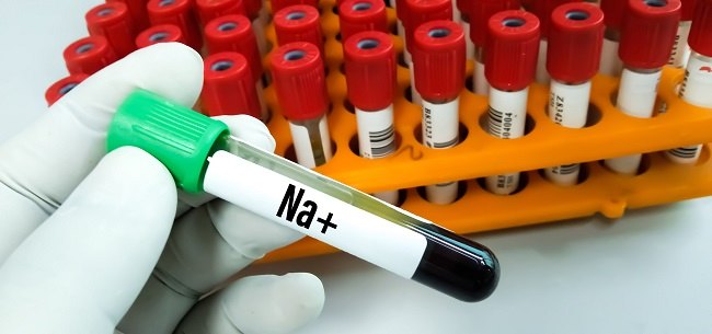 Tolvaptan - Manfaat, Dosis, dan Efek Samping - Alodokter