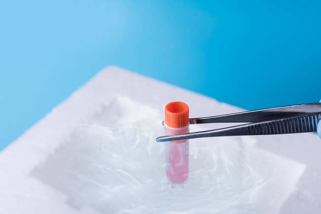 Pembekuan Sel Telur, Hal-Hal yang Perlu Diketahui - Alodokter