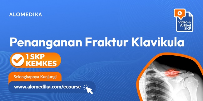 Terapi Konservatif vs Pembedahan pada Fraktur Klavikula - Alomedika