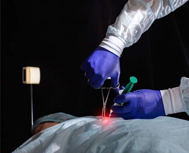 Biopsi Hati - teknik, indikasi, komplikasi, pedoman klinis - Alomedika