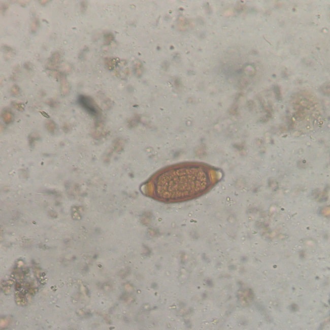 Diagnosis Trichuriasis - Alomedika