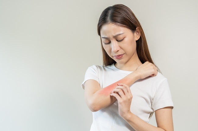 Diflucortolone - Manfaat, Dosis, dan Efek Samping - Alodokter