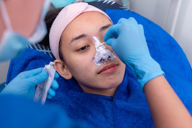 Lidocaine Topikal - Manfaat, Dosis, dan Efek Samping - Alodokter