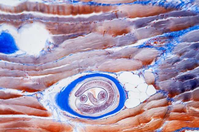 Trichinosis - Gejala, Penyebab, dan Pengobatan - Alodokter