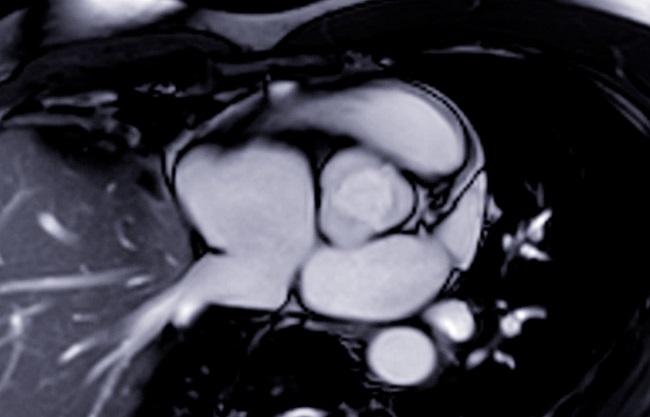 Edukasi Pasien MRI Jantung - Alomedika