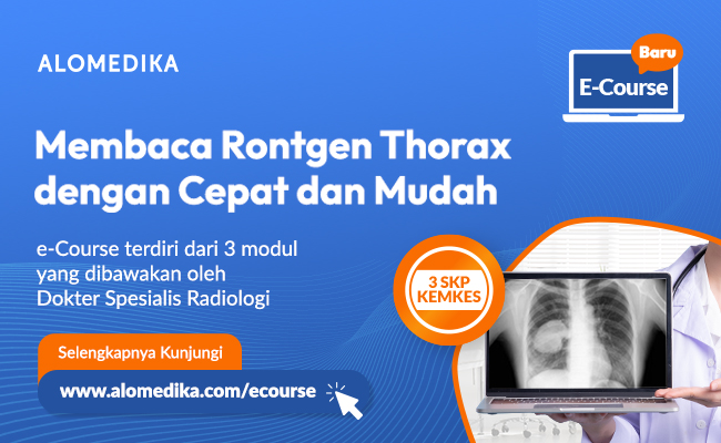E-Course Membaca Rontgen Thorax dengan Cepat dan Mudah - Alomedika
