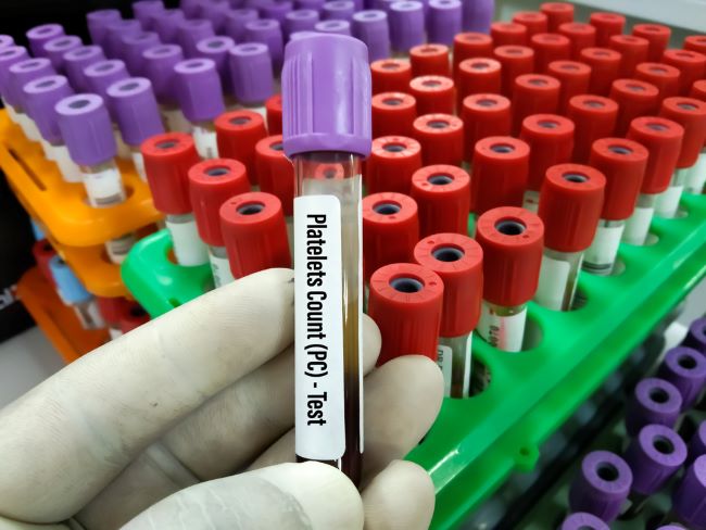 Inilah Trombosit Normal Anak dan Cara Menjaganya - Alodokter