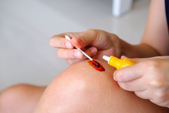 Luka Infeksi, Kenali Ciri-Ciri dan Pengobatannya yang Tepat - Alodokter