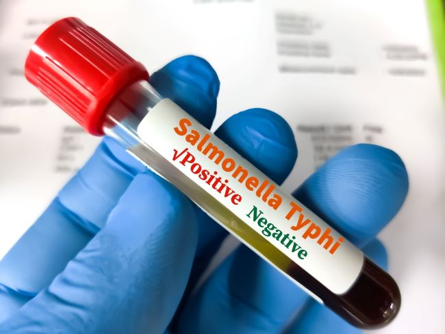 Bakteri Salmonella Typhi dan Demam Tifoid – DEPOK POS