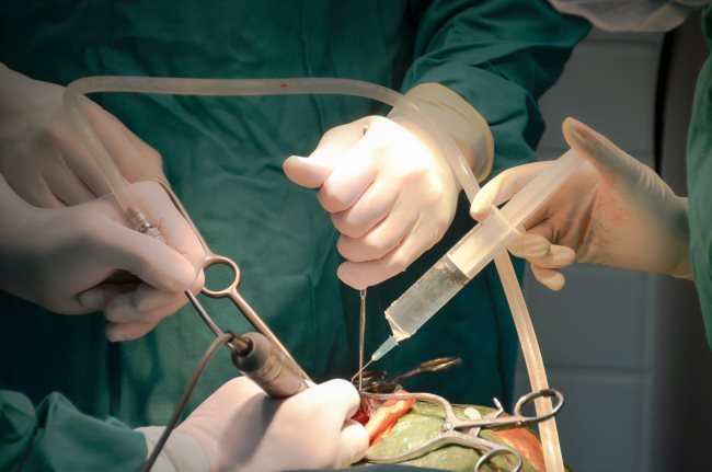 Operasi Implan Koklea, Ini yang Harus Anda Ketahui - Alodokter