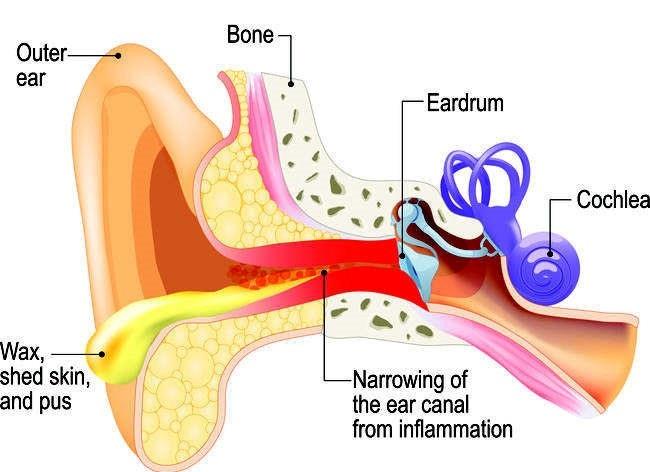 Otitis Eksterna - Gejala, Penyebab, dan Pengobatan - Alodokter