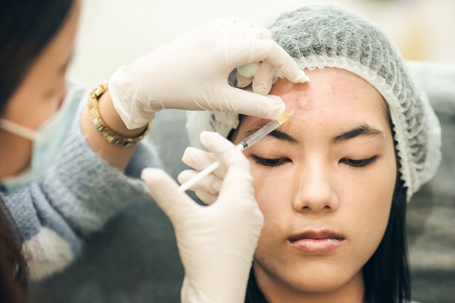 Injeksi Kortikosteroid Intralesi untuk Acne Vulgaris - Alomedika