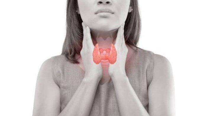 Tumor Tiroid - Gejala, Penyebab, dan Pengobatan - Alodokter