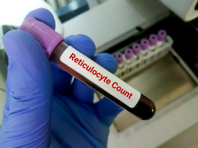 Retikulosit, Sel Darah Merah yang Masih Muda - Alodokter