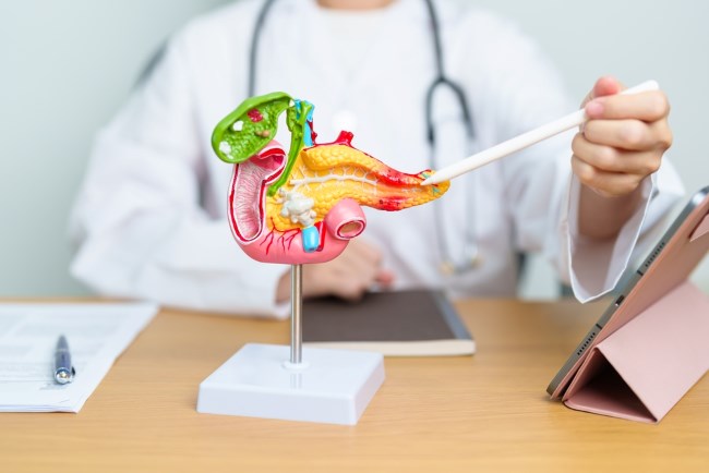 Tumor Pankreas: Penyebab, Gejala, dan Penanganannya - Alodokter