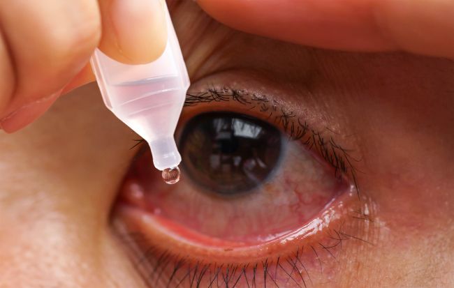 8 Obat Mata Merah Belekan yang Ampuh - Alodokter