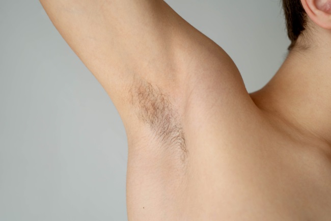 Cara Menghilangkan Bulu Ketiak Secara Permanen - Alodokter