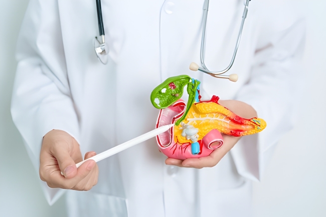 Tumor Pankreas - Gejala, Penyebab, dan Pengobatan - Alodokter