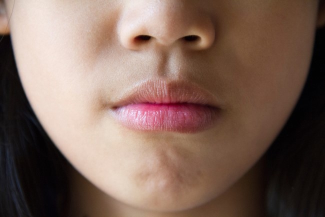 Filtrum, Lekukan di Antara Bibir Atas dan Hidung - Alodokter