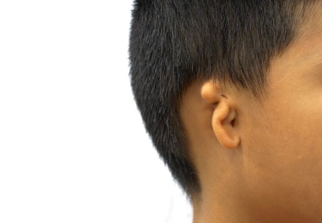 CHARGE Syndrome – Gejala, Penyebab, dan Pengobatan – Alodokter