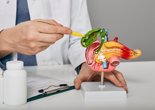 6 Penyakit Empedu dan Gejalanya - Alodokter