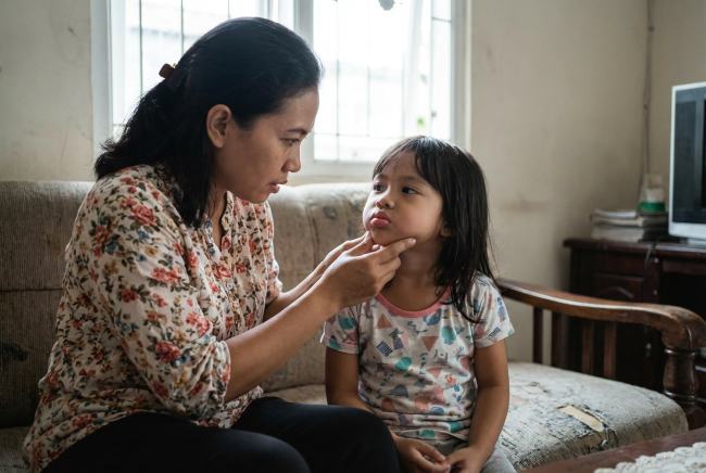 Bibir Anak Tiba-Tiba Bengkak, Ketahui Penyebab dan Pertolongan ...