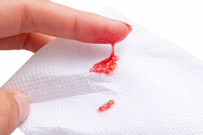 Ingus Berwarna Merah, Ketahui Penyebab dan Cara Mengatasinya - Alodokter
