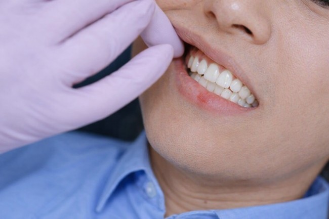 Gusi Geraham Bengkak, Inilah Penyebab dan Cara Mengatasinya - Alodokter