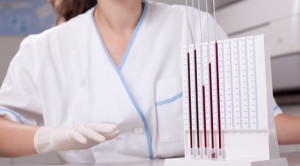 Penjelasan Hasil Pemeriksaan Tes Widal - Tanya Alodokter