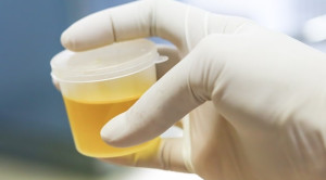 Artikel Terkait - Alomedika