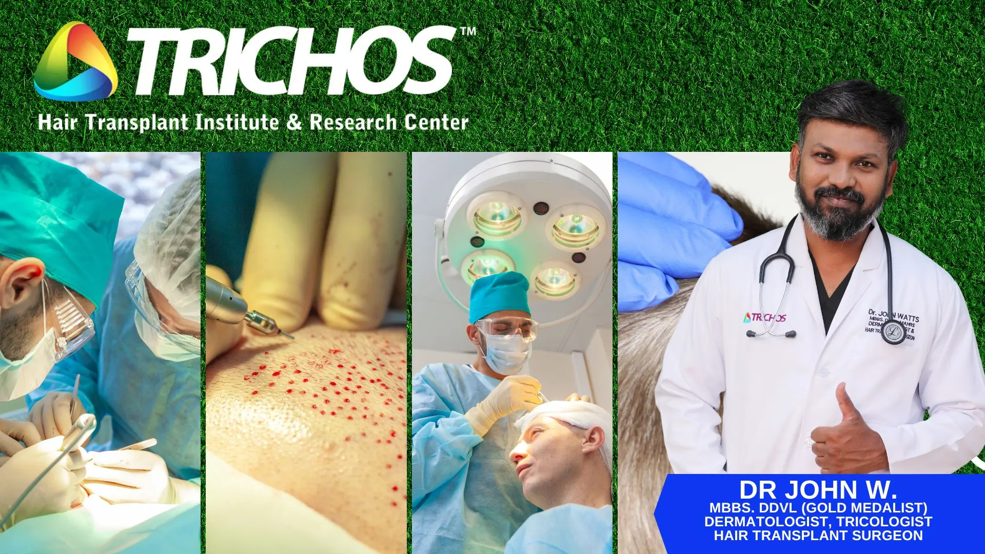 TRICHOS | Hair Transplant in Hyderabad