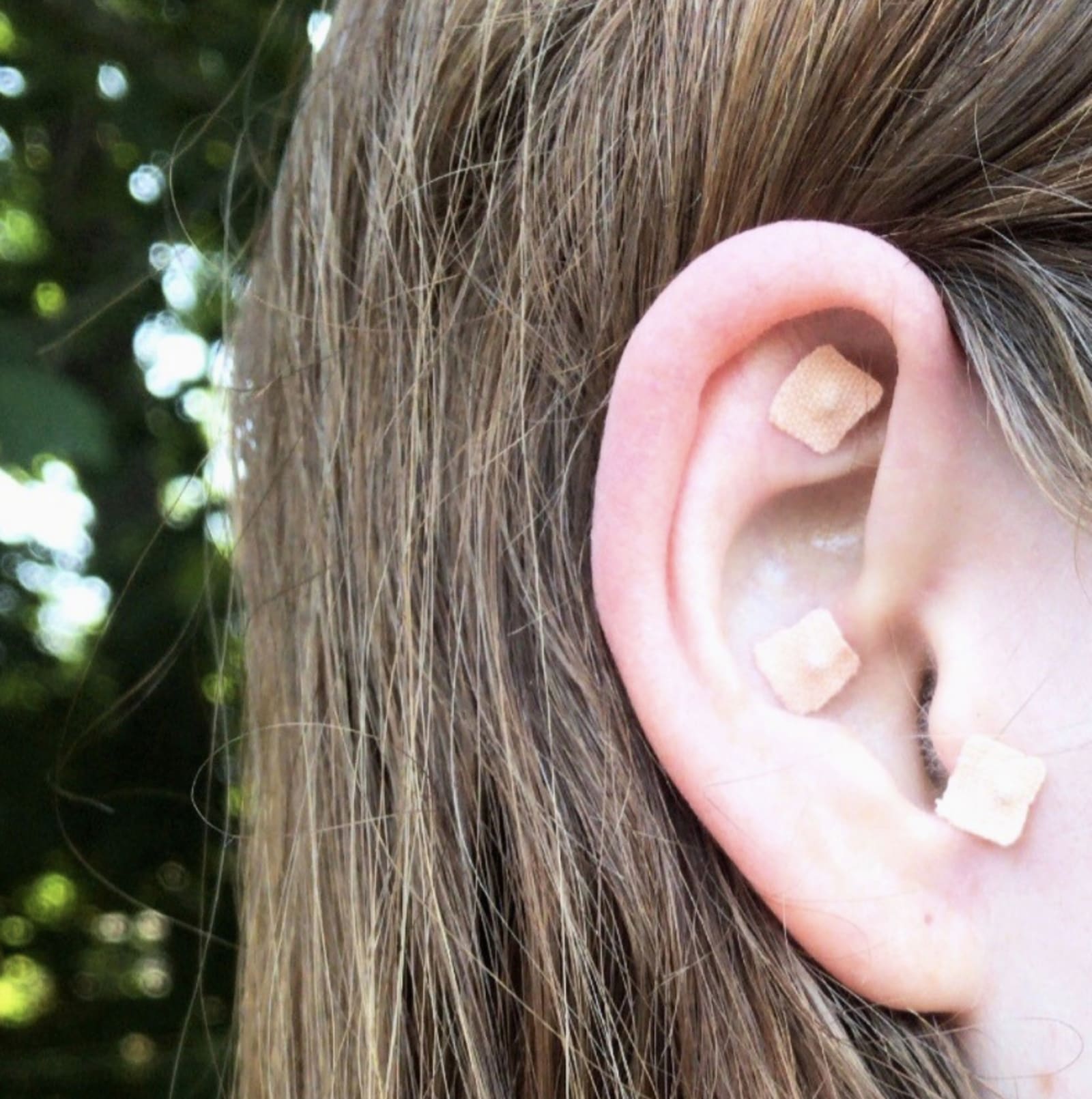 Exploring the Benefits of Auriculotherapy