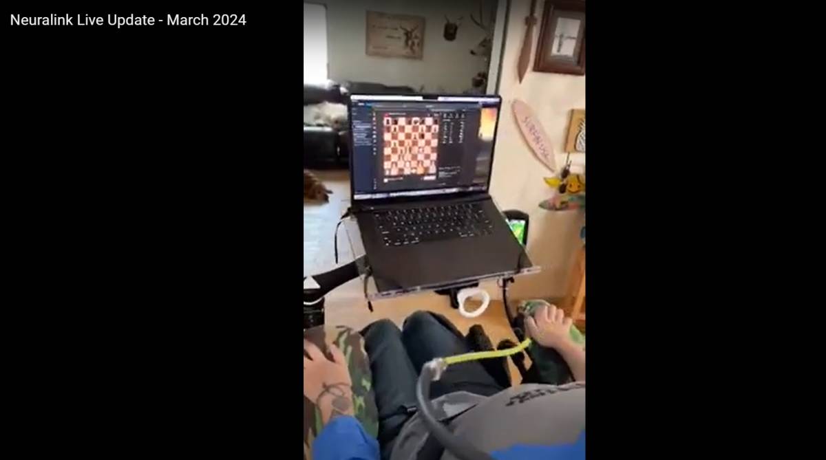 Neuralink update | WIRED