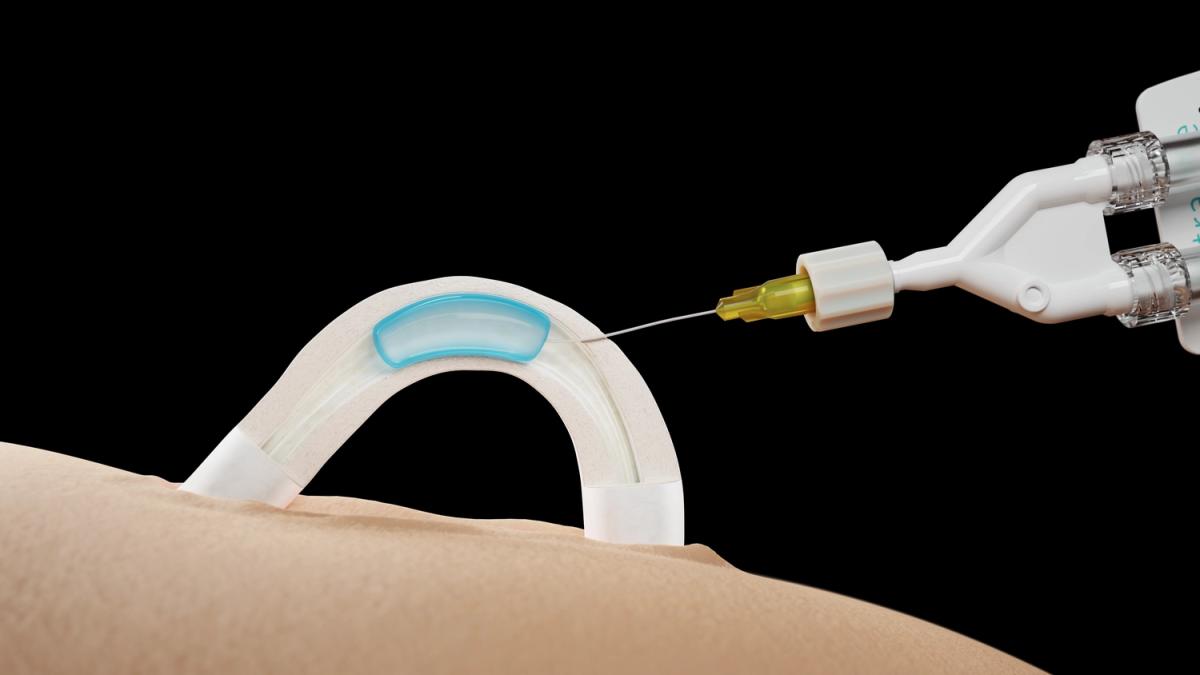 Posun v mužské antikoncepci | WIRED