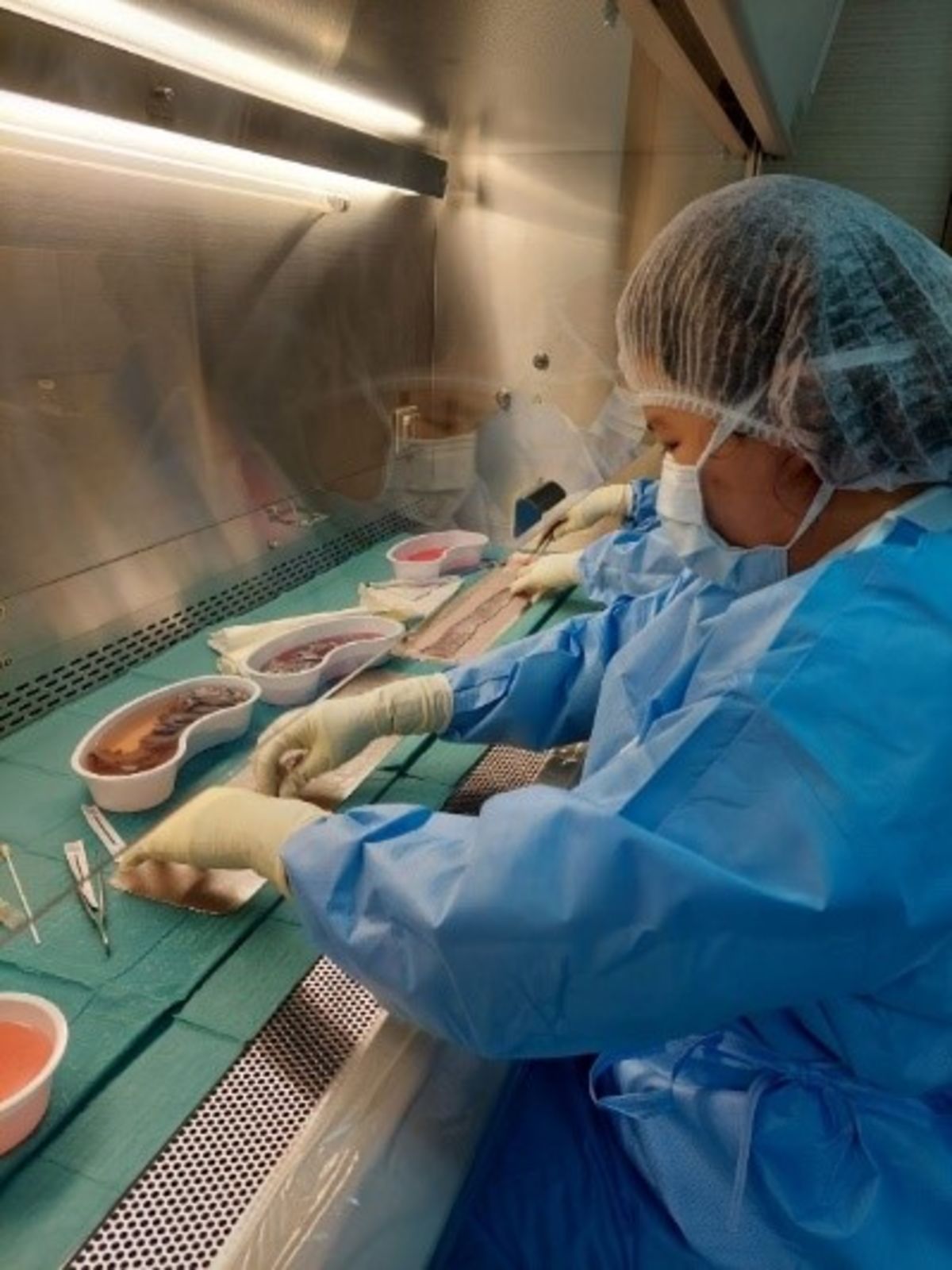 Saving Lives Through Cell Therapy at SGH Skin Bank