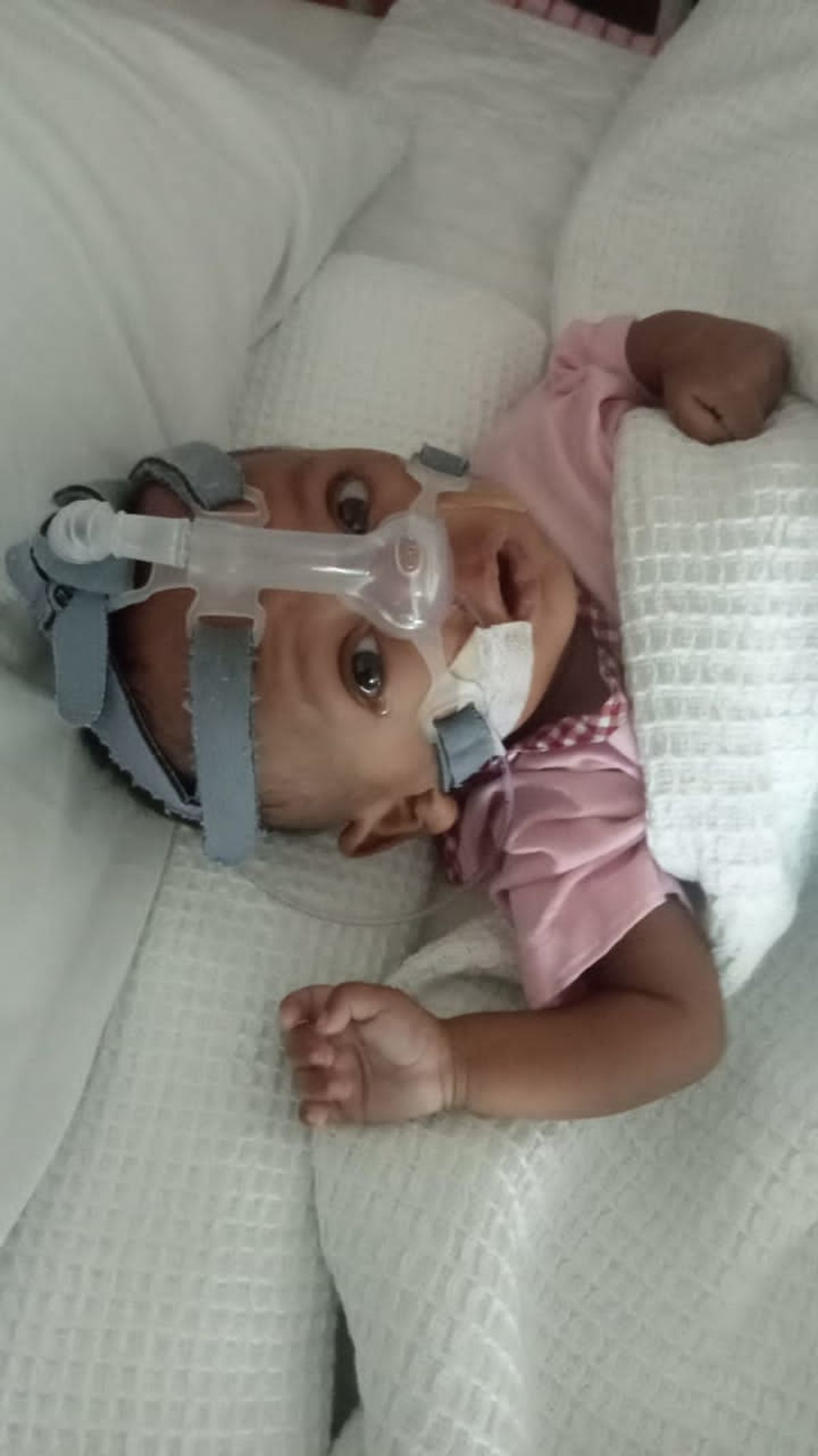 Please help Baby Ismail battles Severe Pneumonia and Meningitis