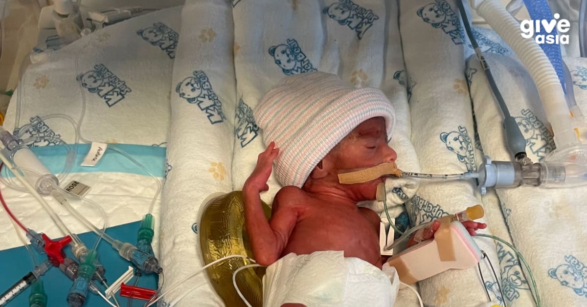Help My Extreme Premature Baby Ekadashi [Big Heart for Little Ones]
