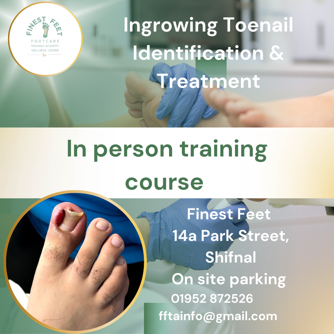 Finest Feet Training Academy | Ingrowing Toenails Identification ...