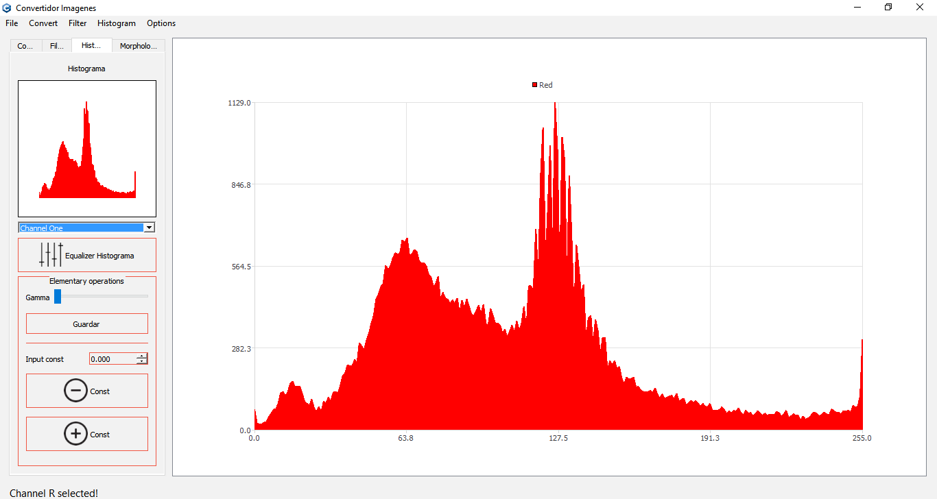 GitHub - dejuata/Retinal-image-processing: Software made in the course ...