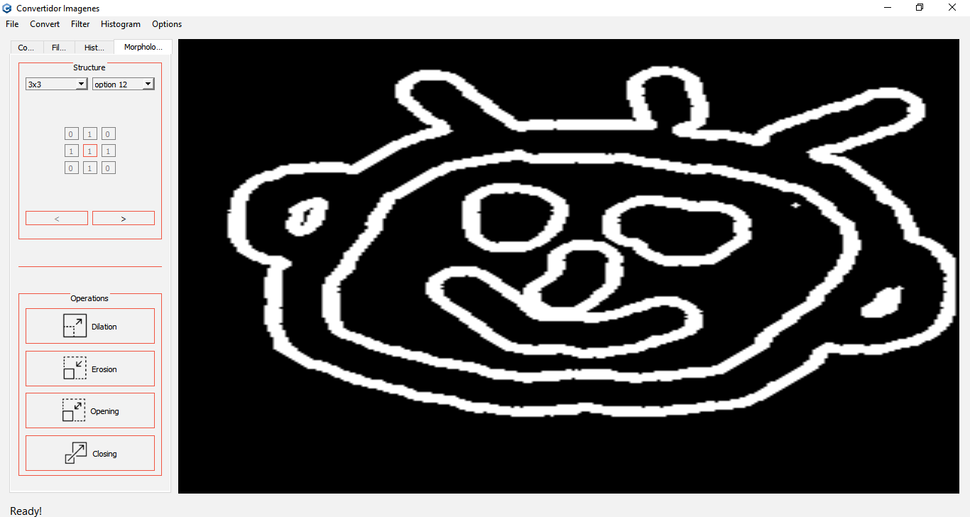 GitHub - dejuata/Retinal-image-processing: Software made in the course ...